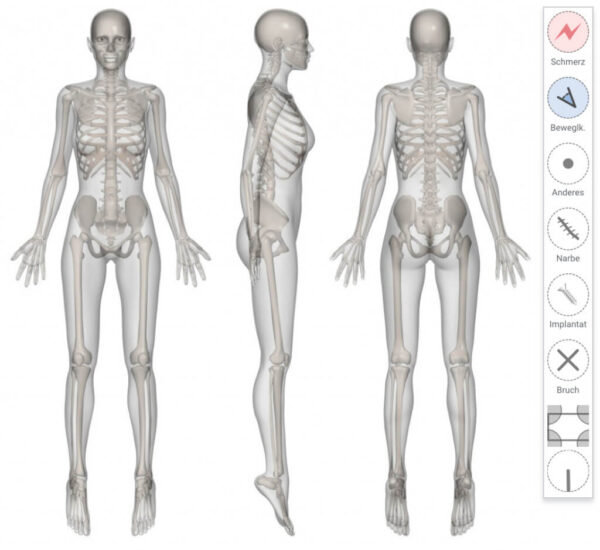 Die VAS-Schmerzskala in der Therapie: Das musst Du wissen!